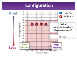 Understanding the Audiogram | Arizona Hearing Specialists
