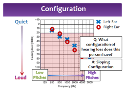 Understanding the Audiogram | Arizona Hearing Specialists