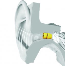 Lyric Hearing Aids | Arizona Hearing Specialists